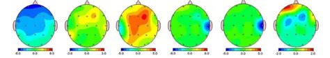 Quantitative EEG Sinha Clinic Call Us To Schedule A Brain Map