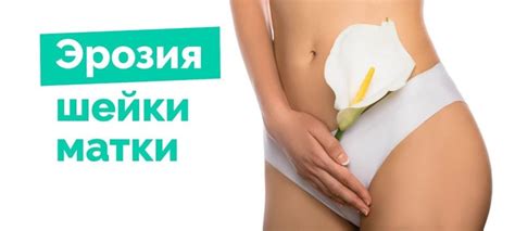 «Эрозия шейки матки лечить или не лечить Etel