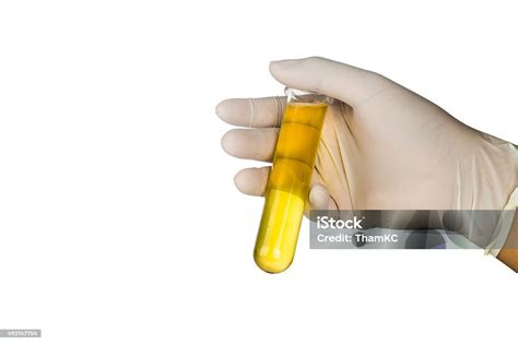 손 라텍스 장갑을 쥠 테스트 튜브와 황색 액체로 수득한다 2015년에 대한 스톡 사진 및 기타 이미지 2015년 건강관리와 의술 과학 Istock