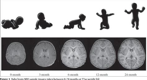 Figure 1 From Iseg Wnet Volumetric Segmentation Of Infant Brain Mri Images Semantic Scholar