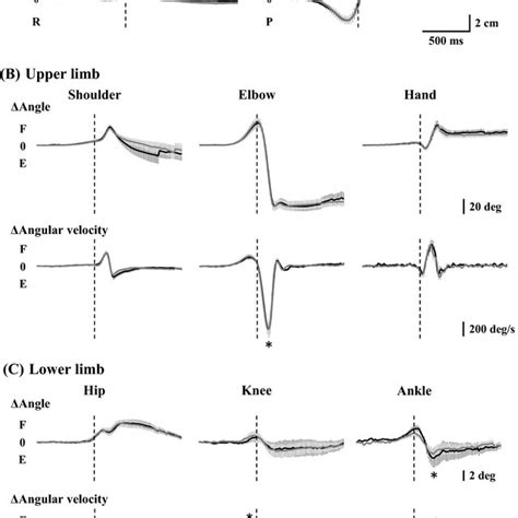 Kinematic Parameters In The Time Course A Displacement Of Cop