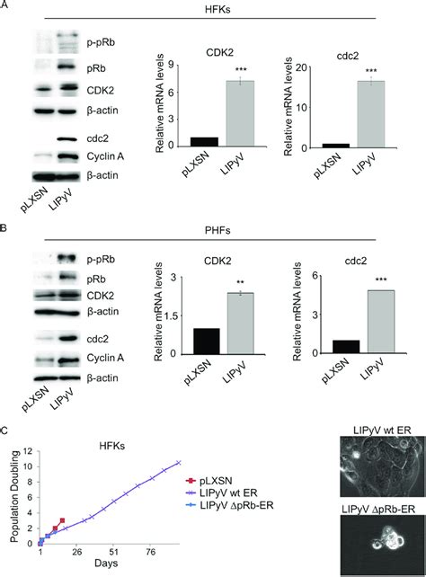 Lipyv Er Alters Prb Function In Cell Cycle Control A And B Protein Download Scientific