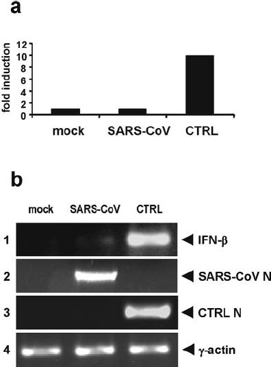 Subcellular Localization Of Irf 3 Early In Infection Confo Cal Double
