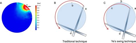 Yes Swing Technique For Small Incision Lenticule Extraction Surgery