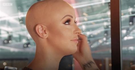 여성 탈모도 패션이다英서 대머리 모델 캠페인 생겨나