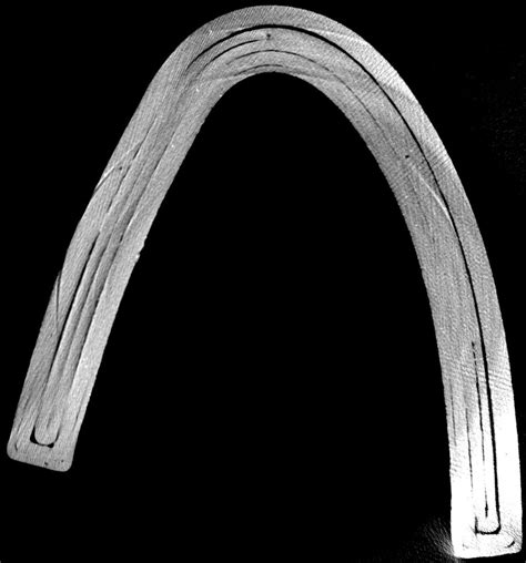 Select Complex Area For Segmentation Support 3d Slicer Community