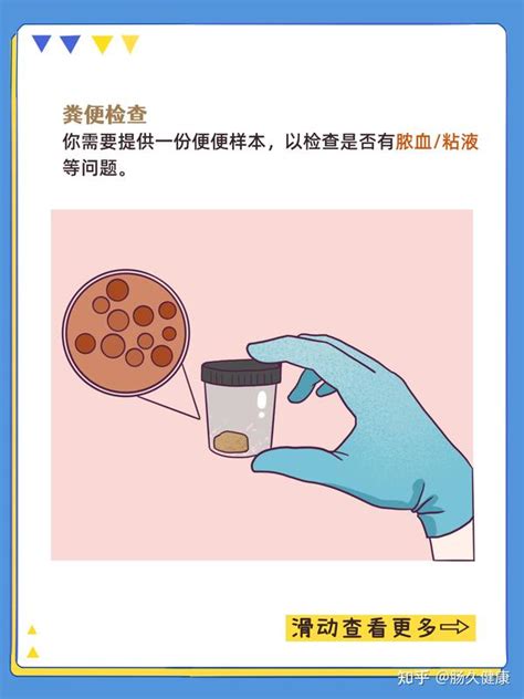 便秘赖着不走这些检查看透你的难言之隐 知乎