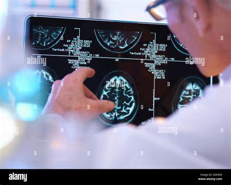 Ct Scan Brain Hi Res Stock Photography And Images Alamy