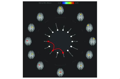 Increased Fc Between Left Stn And Left Gpe And Increased Fc Between Download Scientific