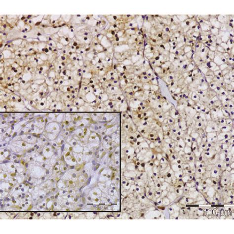 Evaluation Of Yes Associated Protein 1 Yap1 And Download