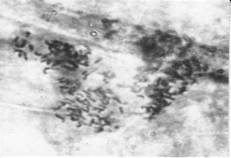 A Polyploid Cell At Early Anaphase Download Scientific Diagram
