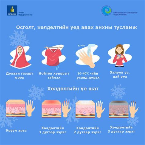 Сүхбаатар дүүргийн Эрүүл мэндийн төв 🥶🥶Осголт хөлдөлтөөс урьдчилан сэргийлье Хөлдөлтийн үед