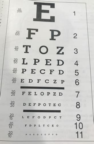 Aandp2 Lab Week 5 Exercise 36 Visual Tests And Demonstrations Flashcards