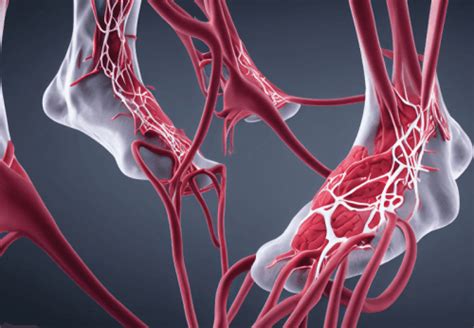 Basil 2 Revascularization Of Infra Popliteal Territory In Patients With Critical Lower Limb
