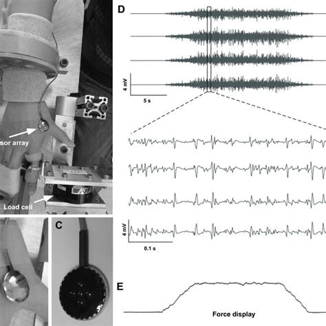 Fig A2 Intramuscular And Surface Emg Signals And Identified Spike