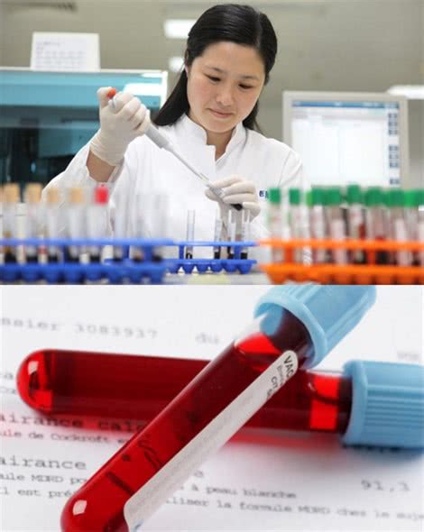 揭秘：体检抽的血都去哪了？原来是被这样处理了血液