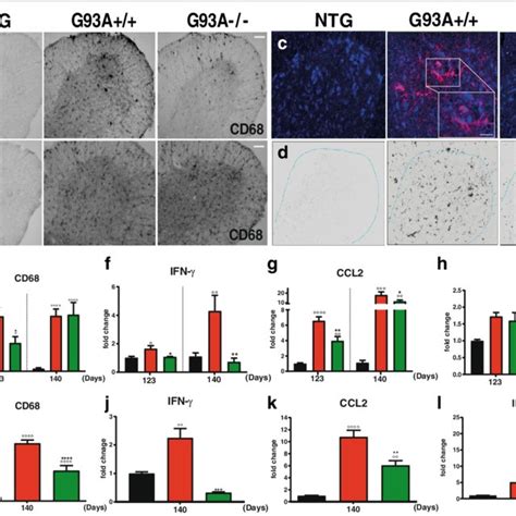 Mhci And Ctls Depletion Promotes Motor Neuron Survival In Msod1 Mice Download Scientific