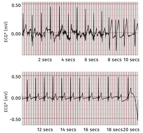 What Is This R Readmyecg