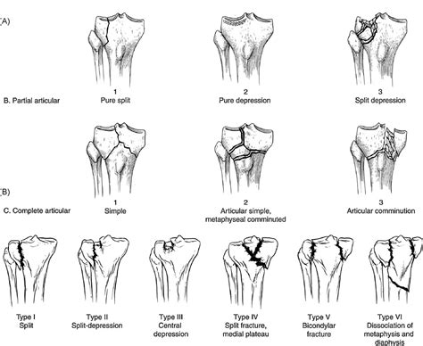 Figure 1 From Three Dimensional Computed Tomography Imaging Increases The Reliability Of