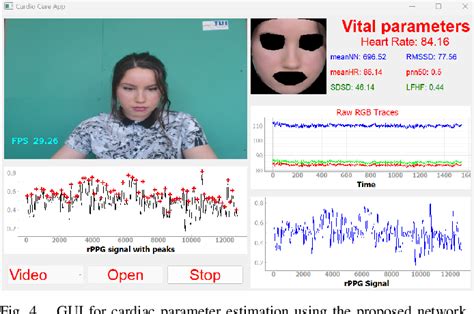 Figure 1 From Timefrequency Learning Framework For Rppg Signal