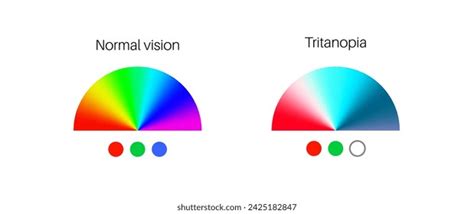 Tritanopia Vision Color Blindness Infographic Human Stock Vector