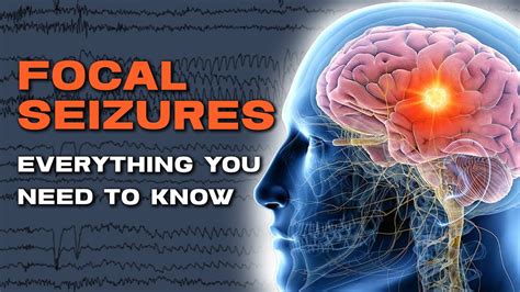The Truth About Focal Automatism Seizures Youtube
