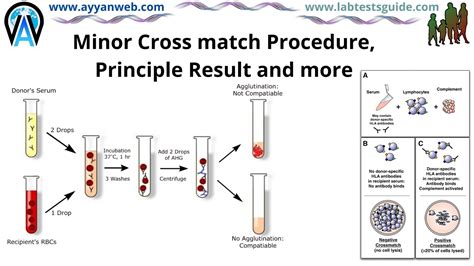 What Is Cross Matching And Its Types At Rodney Jasper Blog
