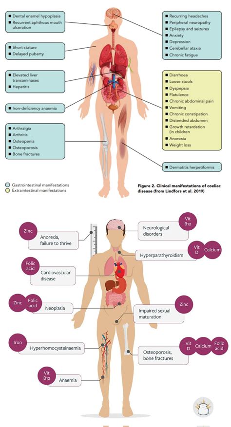 Dermatitis Herpetiformis Mouth