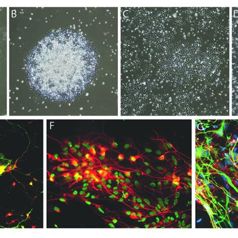 Examples Of Ipsc Derived Cells A E Generation Of Dopaminergic