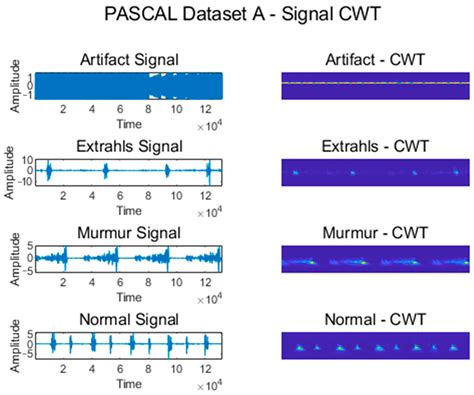 Applied Sciences Free Full Text Heart Sound Classification Using Wavelet Analysis Approaches