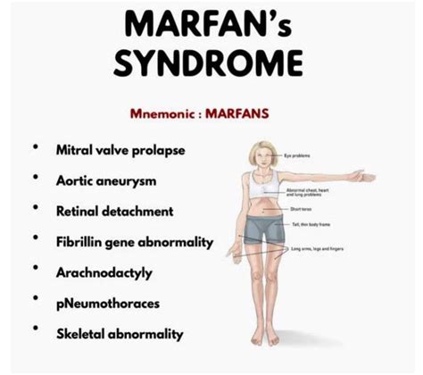 Marfan Syndrome Body