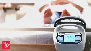 Sequential Compression Device SCD FAQ 47 OFF