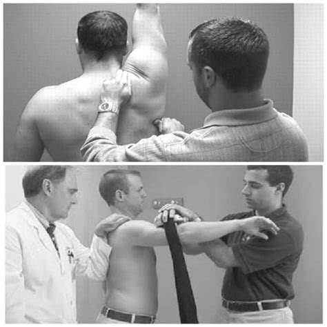Ümit Erkut Linkedinde Scapular Assistance Test Ve Scapular Reposition