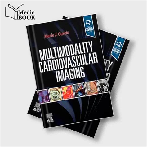 Multimodality Cardiovascular Imaging True Pdf
