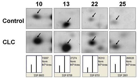 Computed Image Analysis Of Sypro Ruby Stained 2 De Gels A The Download Scientific Diagram