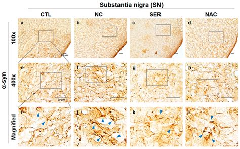 Immunohistochemical Analysis Of Aggregated α Synuclein α Syn Download Scientific Diagram
