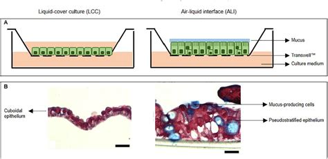 Figure 3 From The Role Of Mucus In Cell‐based Models Used To Screen