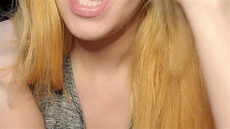 My Mouth After Extracting 3 Rotten Teeth Exploring Yellow Teeth Tongue And How Is It After