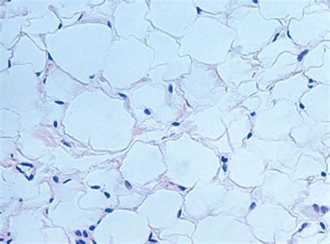 Connective Tissue Microscope Slides Flashcards Quizlet