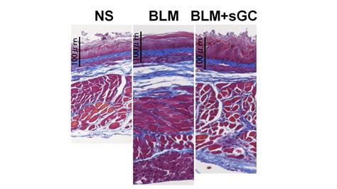 Soluble Guanylate Cyclase Reduced The Gastrointestinal Fibrosis In Bleomycin Induced Mouse Model