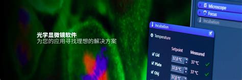 蔡司zeiss（北京）一级代理商，蔡司zeiss光学显微镜，蔡司体视显微镜和变倍显微镜，蔡司激光共聚焦显微镜，蔡司超高分辨率显微镜，蔡司成像系统，蔡司激光显微切割系统，蔡司关联显微镜技术，蔡司