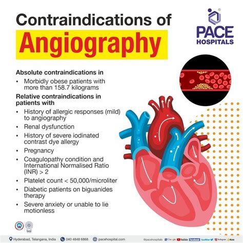 Pace Hospitals On Linkedin Angiogramtest Angiogram Angiogramuses