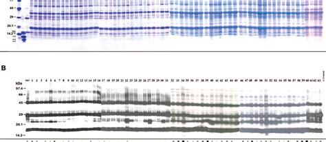Figure 3 From Enzyme Linked Immunosorbent Assay Elisa For Detection Of Sulfur Rich Protein