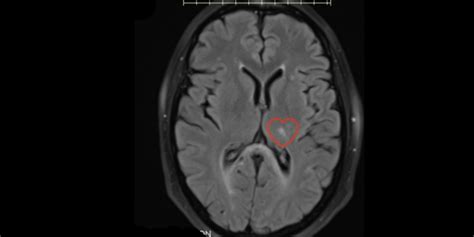 Stroke Me Day 366 Strokeaversary · I Will Dare