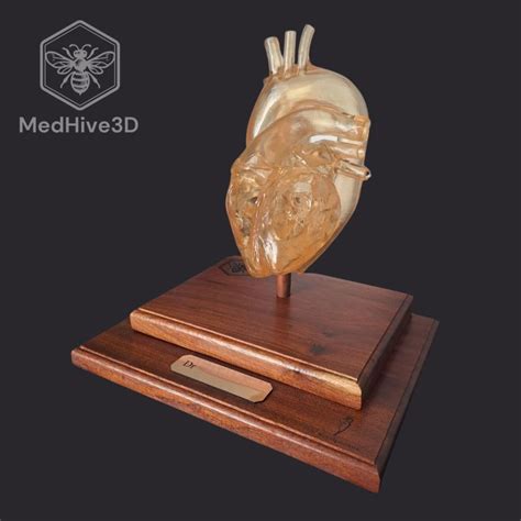 Jan Ackermann On Linkedin Cardiology Patienteducation Medicaleducation 3dprinting