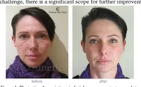 Figure 1 From Genetic Algorithm Based Recognizing Surgically Altered