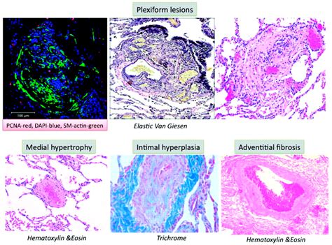 Pulmonary Artery Histology
