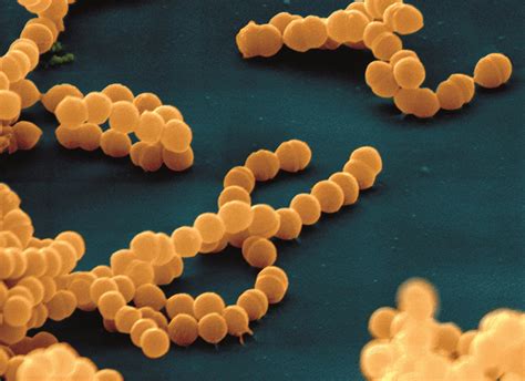 Scarlet Fever Acute Management And Infection Control The