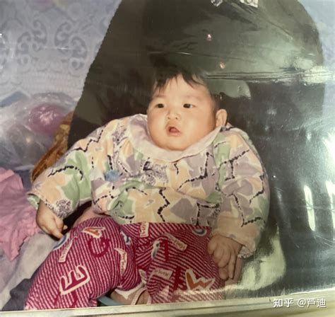 请问阿斯伯格综合征孩子的莫比乌斯嘴型是什么样子？ 知乎