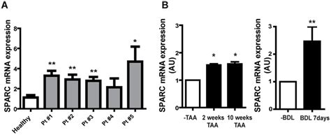 Induction Of Sparc Mrna Expression During Liver Fibrogenesis A